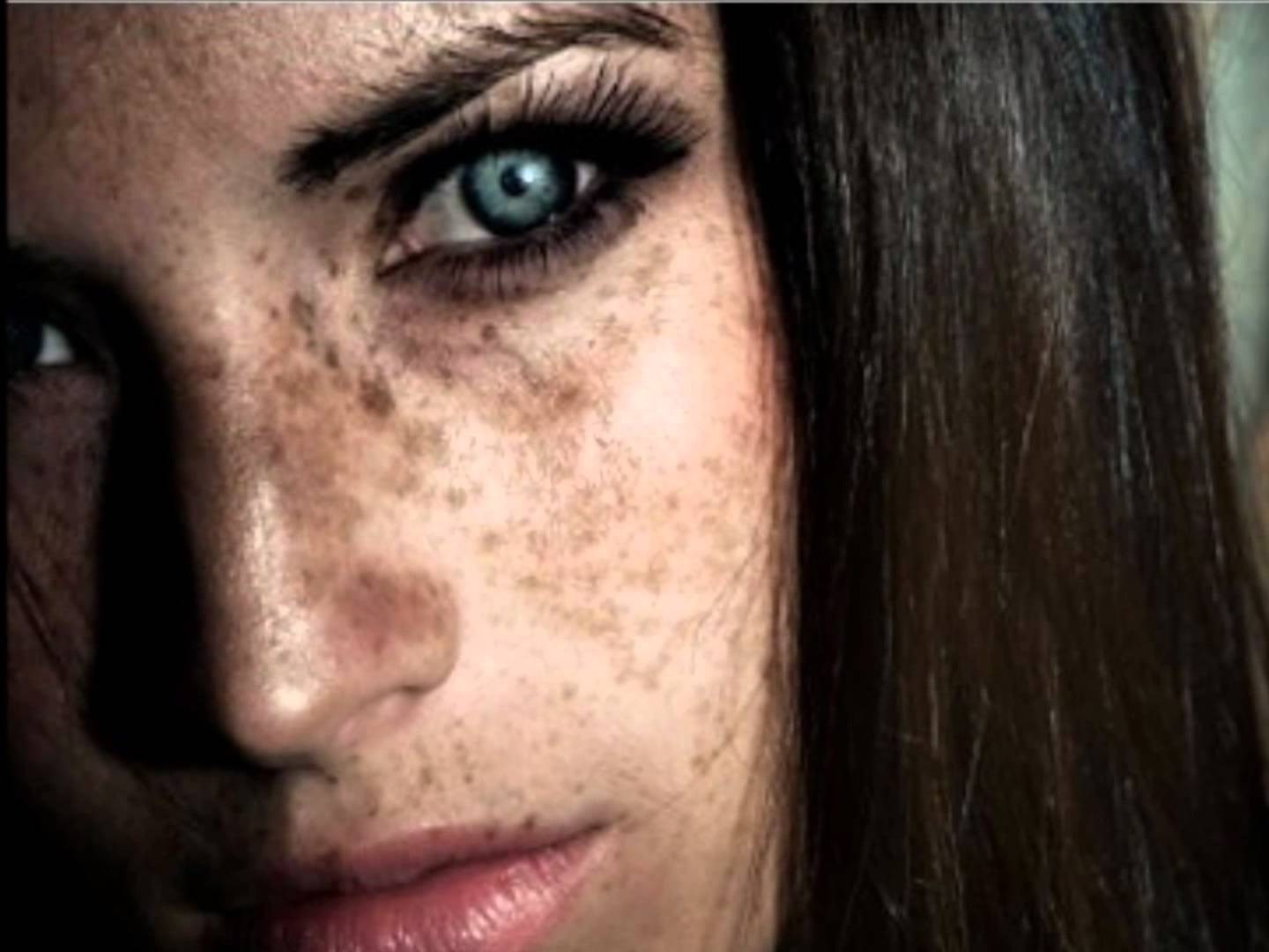 IPL Photofacial Westchester: The Best Freckle Treatment Available